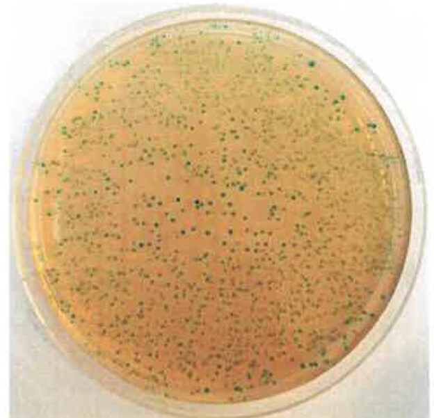 Lactobacillus Agar CROMOKIT