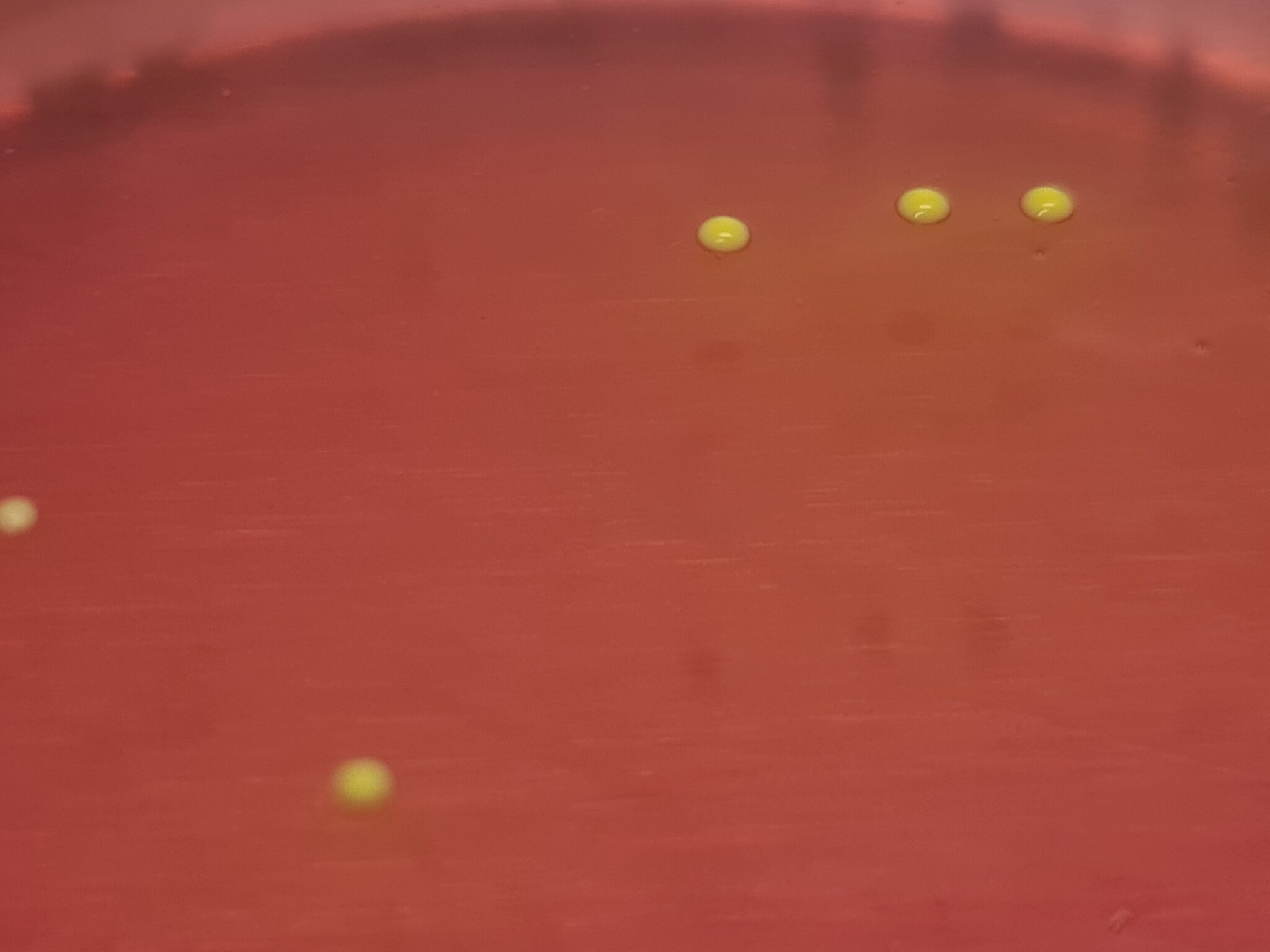 Vogel Johnson Agar